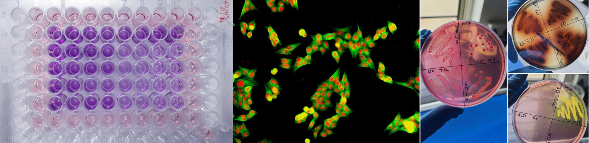 CONTRACT RESEARCH SERVICES - CELLKRAFT BIOTECH PVT. LTD.